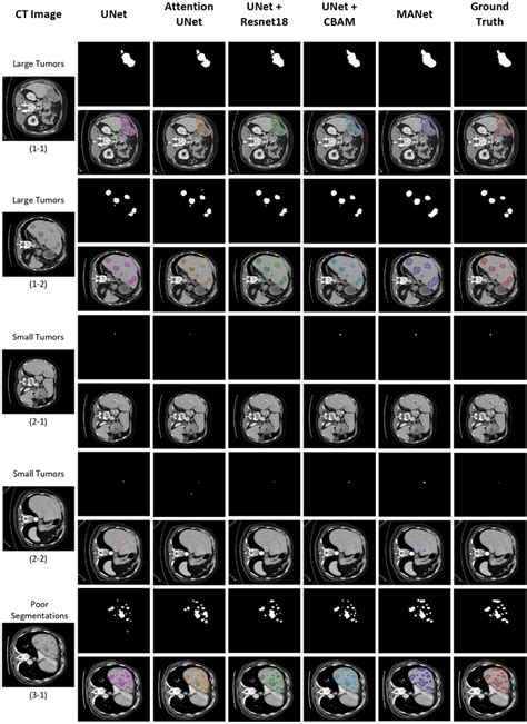 Qualitative Analysis Of Sample Segmentation Generated By Comparison