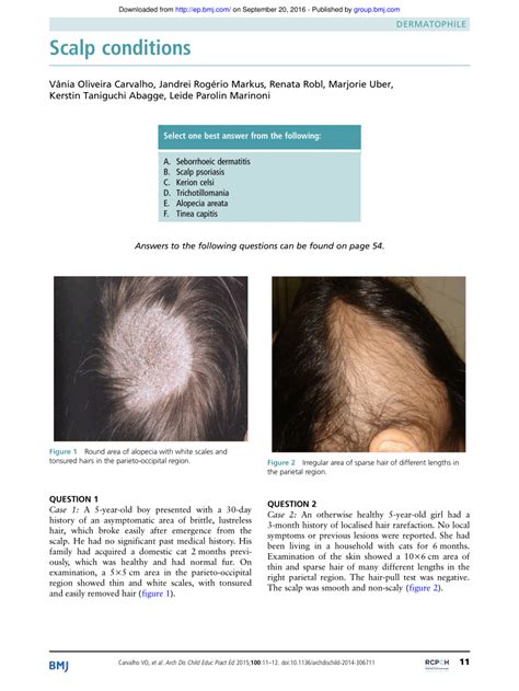 PDF Scalp Conditions