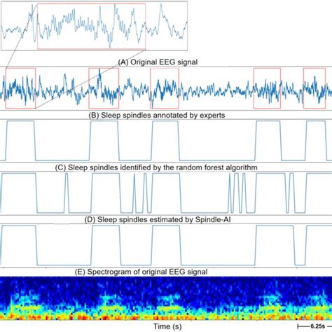 sleep spindle detection criteria a original eeg signal the signal