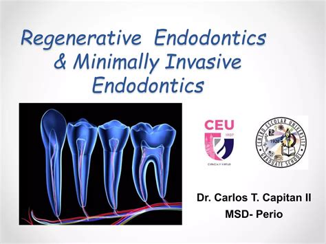 Regenerative Endodontics Ppt