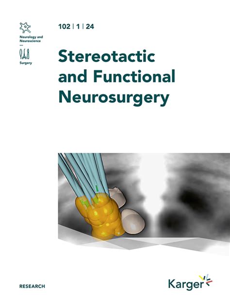 Perspectives Of Implementation Of Closed Loop Deep Brain Stimulation