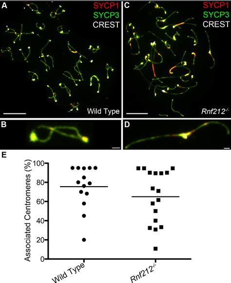 Figure 3 From Interplay Between Synaptonemal Complex Homologous Recombination And Centromeres