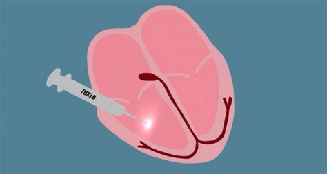bio pacemaker possible through cell reprogramming [video] · guardian