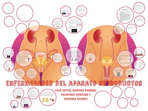 Enfermedades Aparato Reproductor By Stefania Rizescu On Prezi