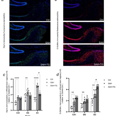 Atf6 Activating Transcription Factor 6 Is A Key Regulator Of The