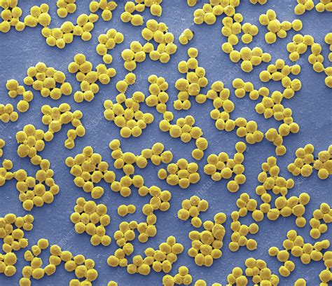 Group A Streptococcus Bacteria Sem Stock Image C057 3750 Science