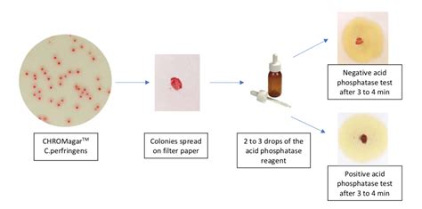 Clostridium Perfringens Colony