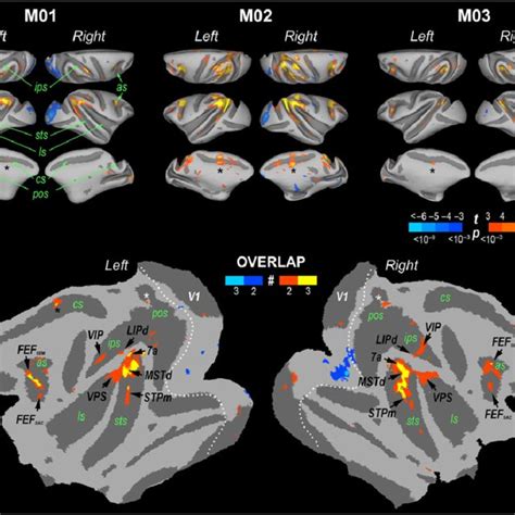A Statistical Parametric Maps For The Ec Versus Ei Contrast In Download Scientific Diagram
