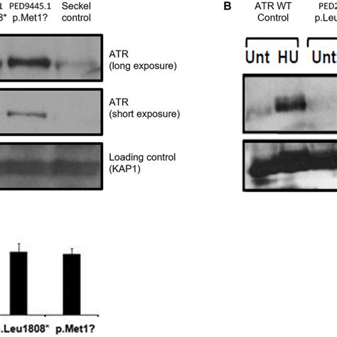 Impact Of Mutations On Atr Expression And Intra S Phase Checkpoint A