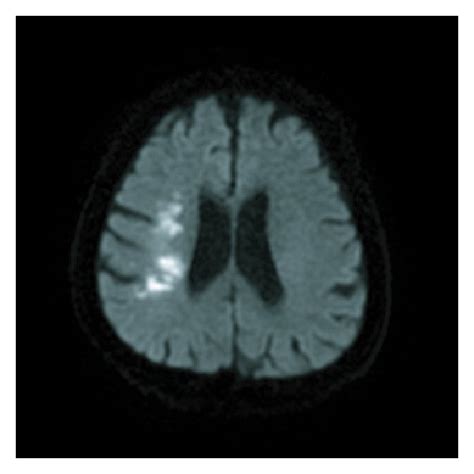 Illustrating The Procedure Of The Proposed Method With Exemplary Download Scientific Diagram