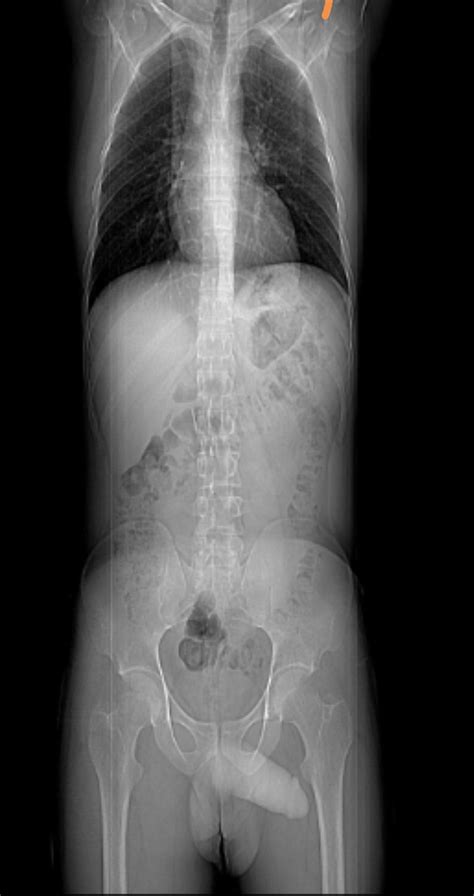 This Is What Our Genitals Look Like On An X Ray R Interestingasfuck