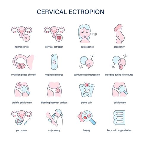 Symptoms Cervical Ectropion