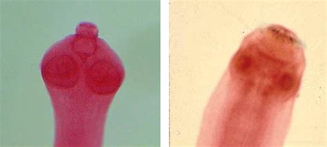 Cestodes Flashcards Quizlet