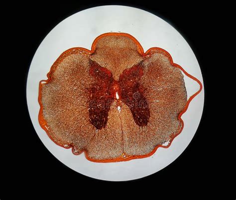 Spinal Nerve Cross Section