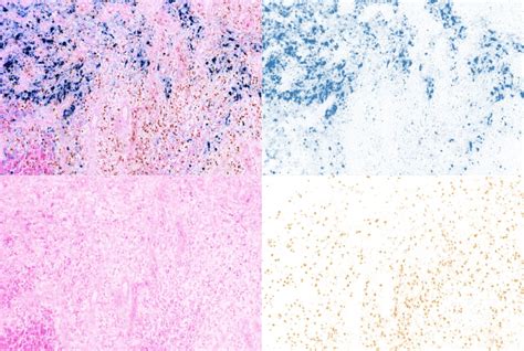 ᴗ• Qupath Scripting 6 Customized 3 Stain Color Deconvolution