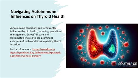 Hyperthyroidism Vs Hypothyroidism Explained Concisely Pdf