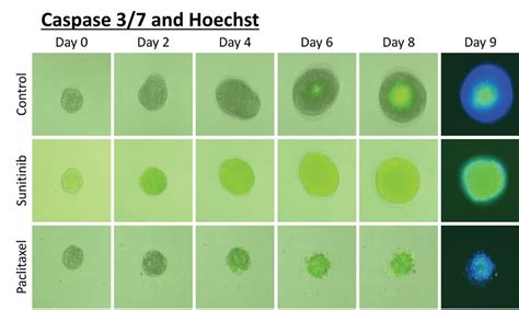 Image Based Automated Analysis Of 3 D Tumor Spheroids