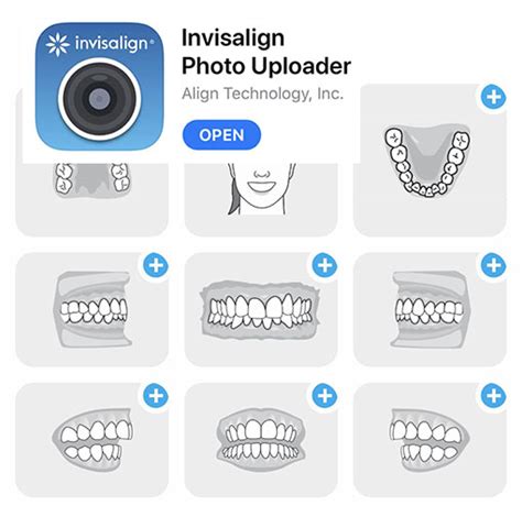 Invisalign Photo Template Download