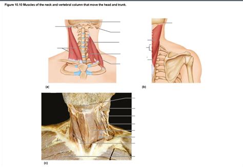 Figure 10 10 Muscles Of The Neck And Vertebral Column That Move The