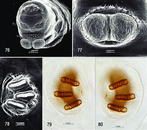 Scanning Electron Photomicrographs And Optical Photomicrographs Of Download Scientific Diagram