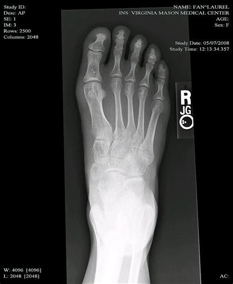 Foot X Ray Dramatic Play Preschool Human Body Science Community