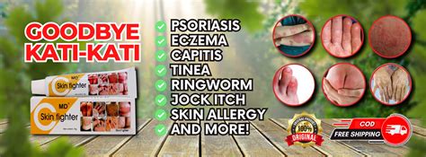 Skin Fighter Ph Goodbye Psoriasis Eczema And Skin Allergies Manila