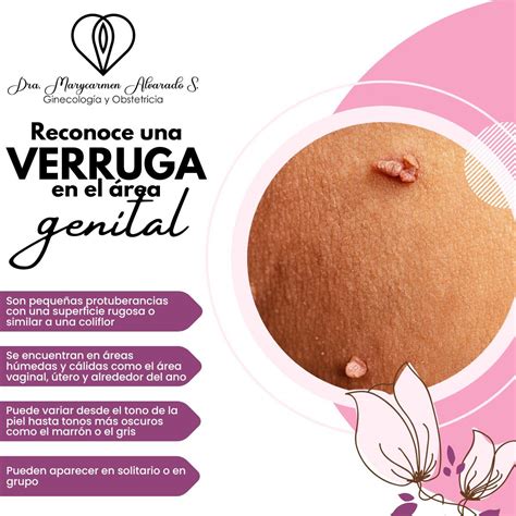 Dra Es Importante Estar Atentos A Nuestra Salud 👀💡 Las Verrugas