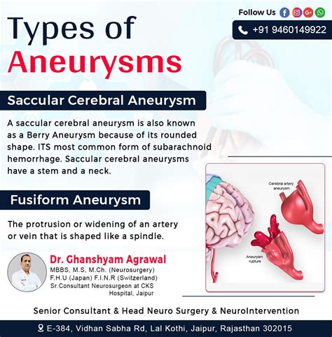 Types Of Aneurysms Saccular Cerebral Aneurysm A Saccular Cerebral