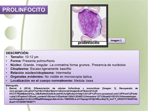 Hematologia 2016 Fichero Prolinfocito