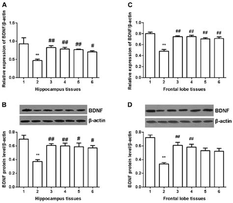 Expression Of Bdnf In Hippocampus And Prefrontal Cortex Tissues Bdnf Download Scientific