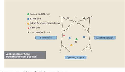 Figure 1 From Minimally Invasive Ivor Lewis Esophagectomy With Linear Stapled Side To Side