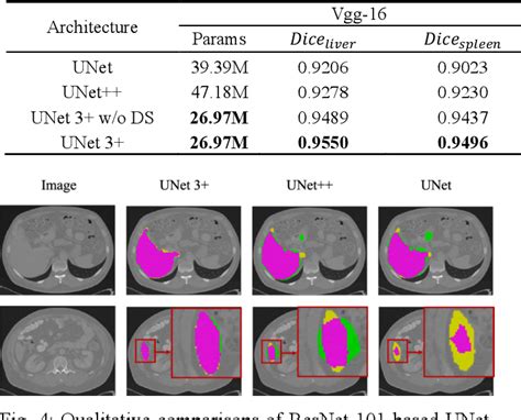 Pdf Unet 3 A Full Scale Connected Unet For Medical Image