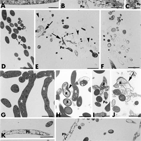 Scanning Electron Micrographs Of Pythium Oligandrum Hyphae Interacting Download Scientific