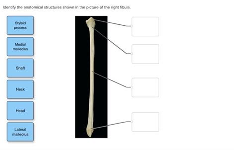 Solved Label The Structures Of Either The Tibia Or Fibula Chegg Com