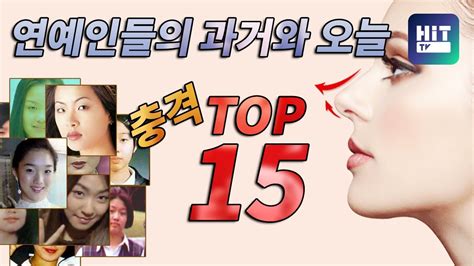 성형전후를 방불케하는 몰라보게 예뻐진 연예인 충격의 Top15 Youtube