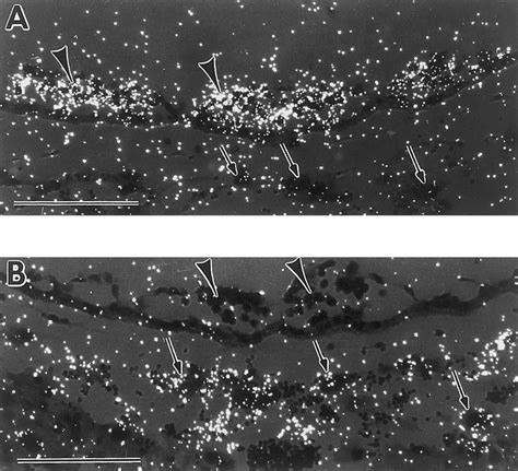 Differential Expression Patterns Of Gata 1 And Gata 2 In Download