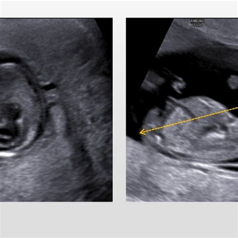 CRL Standard Section A And Measurement Standards B Download