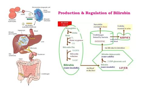Jaundice Significance Production Transportation Metabolism And Laboratory Analysis Medicoinfo