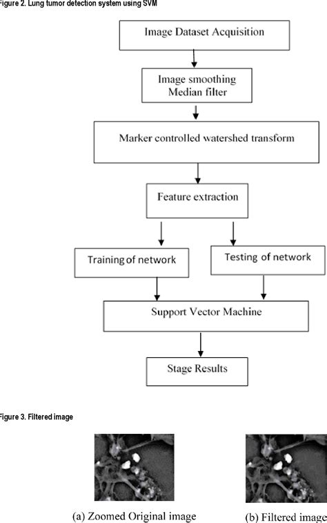 Figure 1 From Lung Tumor Segmentation Using Marker Controlled Watershed And Support Vector