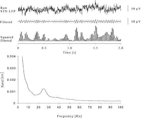 Example Of Raw Data Bandpass Ltered Hz And Squared Activity Download Scientific