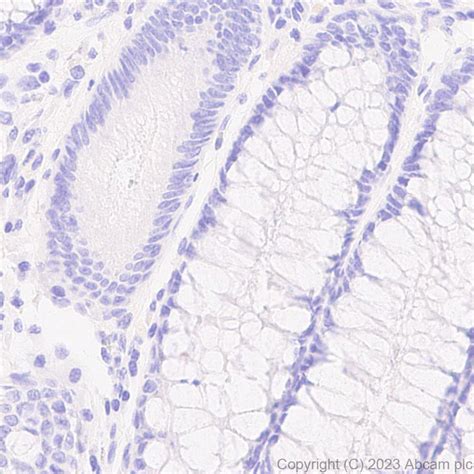 Anti Mycobacterium Tuberculosis Ag85b Antibody Epr28401 54 Ab312328 Abcam