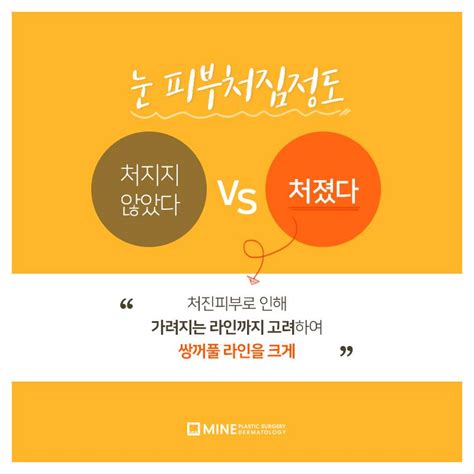 마인성형외과의원 예쁜 라인과 눈을 위한 뷰티포인트 눈성형 프로세스 마인성형외과 눈성형 Facebook