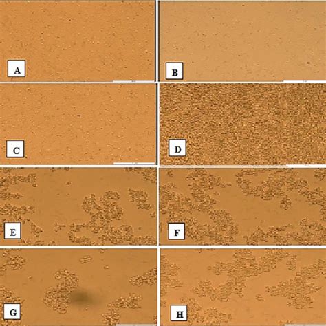 Pdf Complex Coacervation With Whey Protein Isolate And Gum Arabic For The Microencapsulation