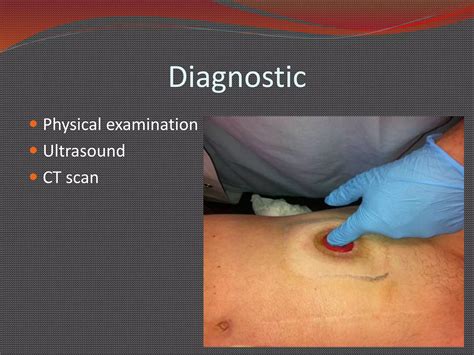2017 Parastomal Hernia In Colorectal Cancer Pptx