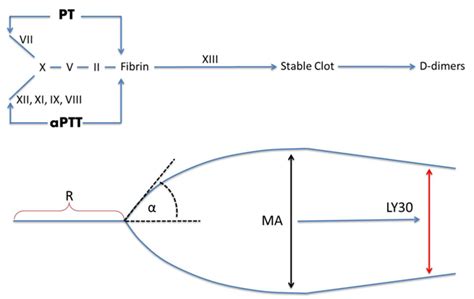 Teg Platelet Mapping Guided Evaluation Of Anti Phospholipid Carrier