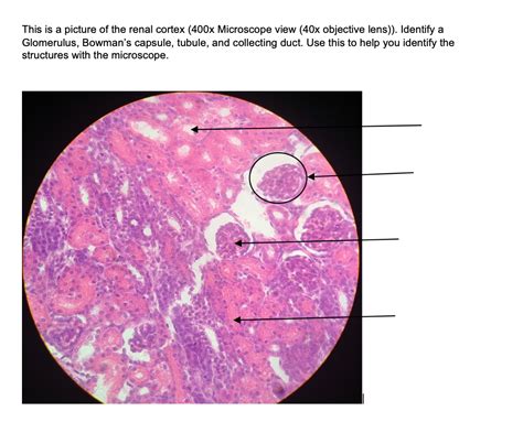 Solved This Is A Picture Of The Renal Cortex 400x