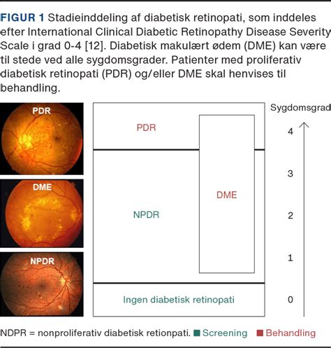 Diabetisk Retinopati Ugeskriftetdk