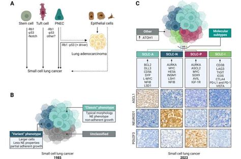 Comprehensive Overview Provides Clinical Insights Into Small Cell Lung