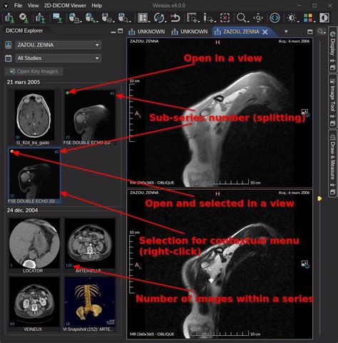 Dicom Explorer Weasis Documentation