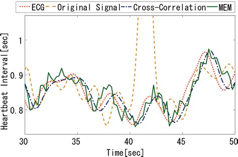 Hrv Reconfigured By Each Signal Download Scientific Diagram